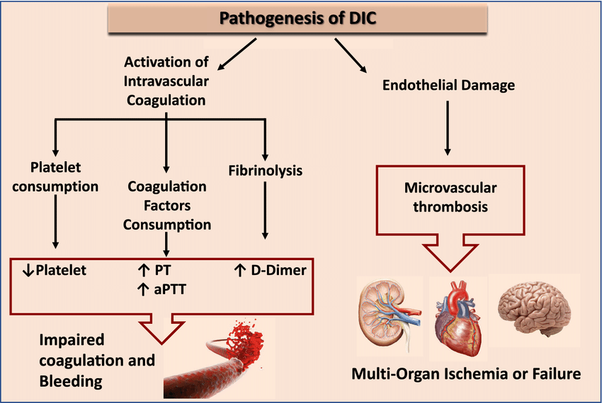 DIC & the Unlucky 7 (IUFD, AFE, AFLP, HELLP, ABRUPTION, SEPSIS) – The ...
