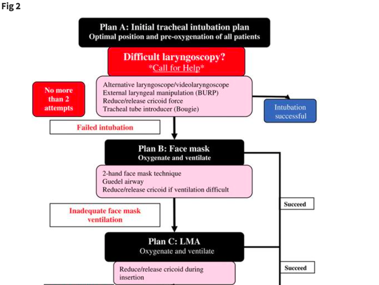 Difficult & Failed OB Airway. – The Dark Neb: Tuohy Time